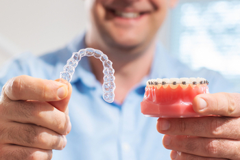 Cost of Braces in Australia: Prices, Options & Payment Plans